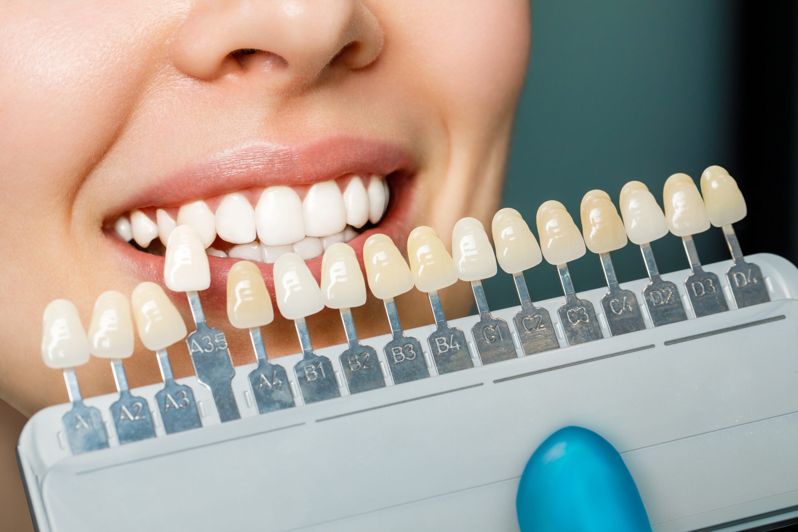 Tooth Replacement Options That Fit Your Life